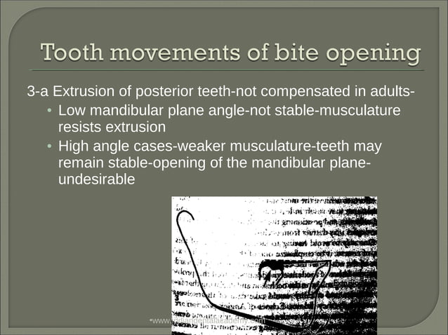 Intrusion arches /certified fixed orthodontic courses by Indian dental ...