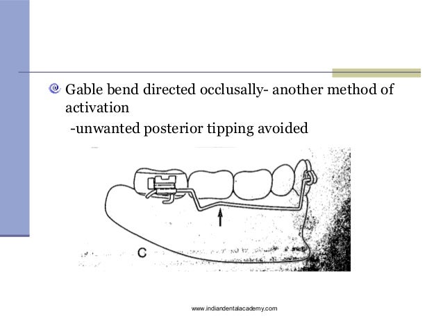 Intrusion arches /certified fixed orthodontic courses by Indian denta…