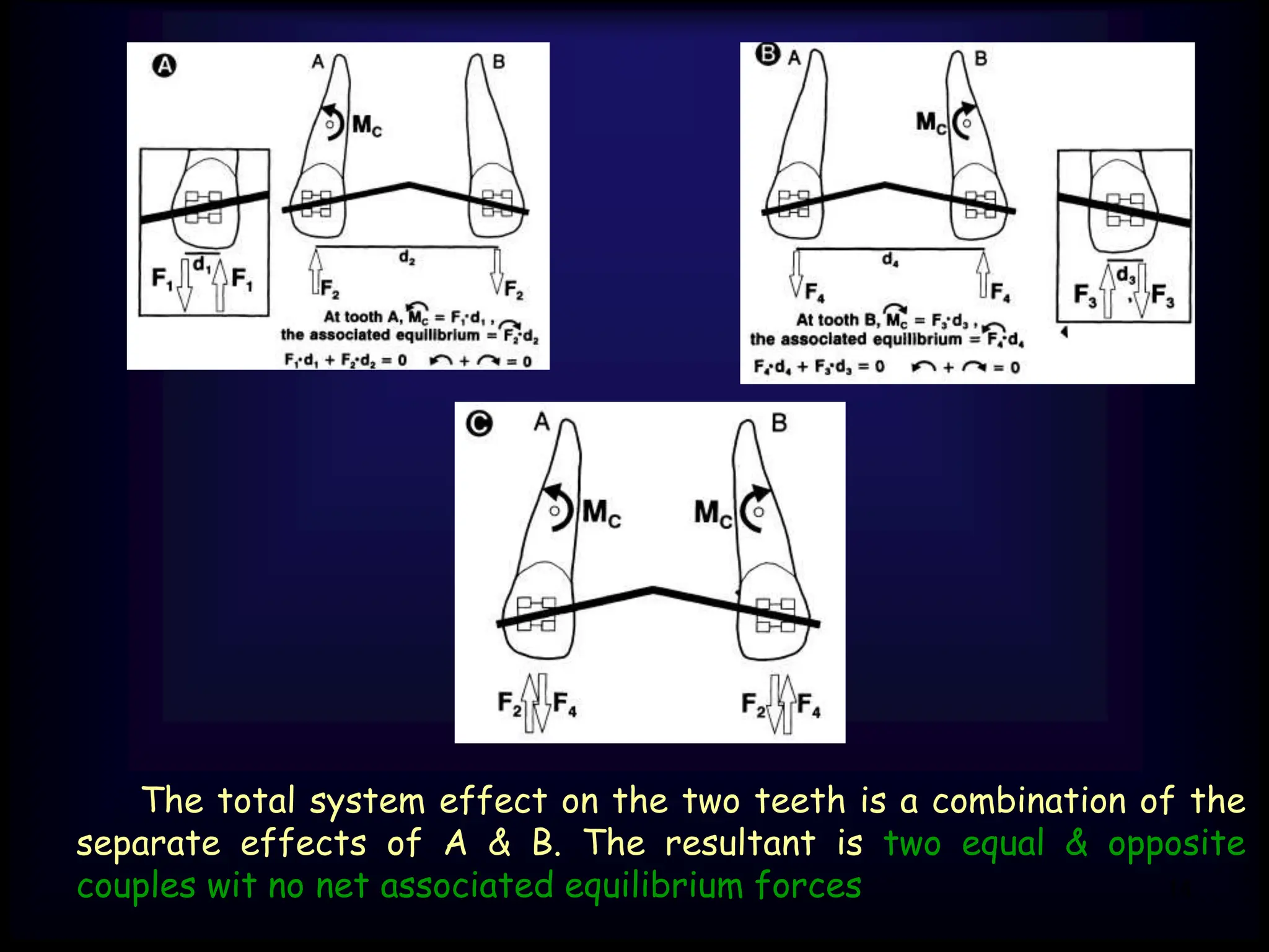 INTRUSION MECHANICS IN ORTHODONTICS..ppt