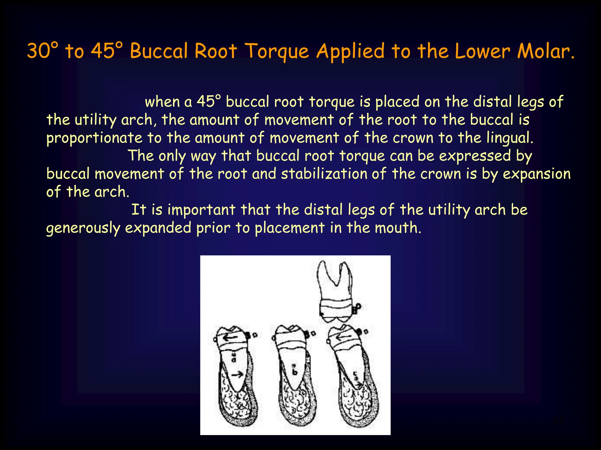 INTRUSION MECHANICS IN ORTHODONTICS..ppt