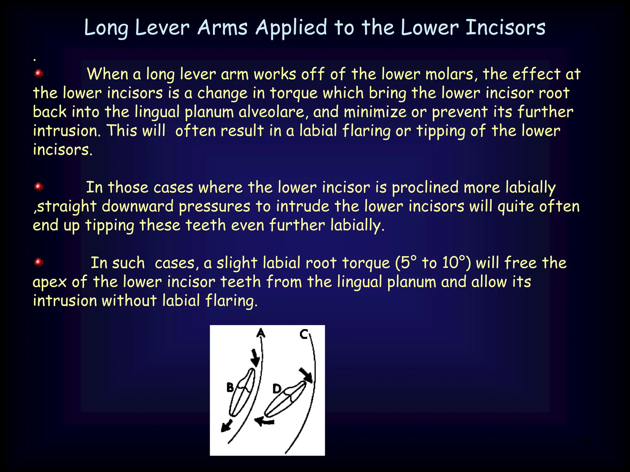 INTRUSION MECHANICS IN ORTHODONTICS..ppt