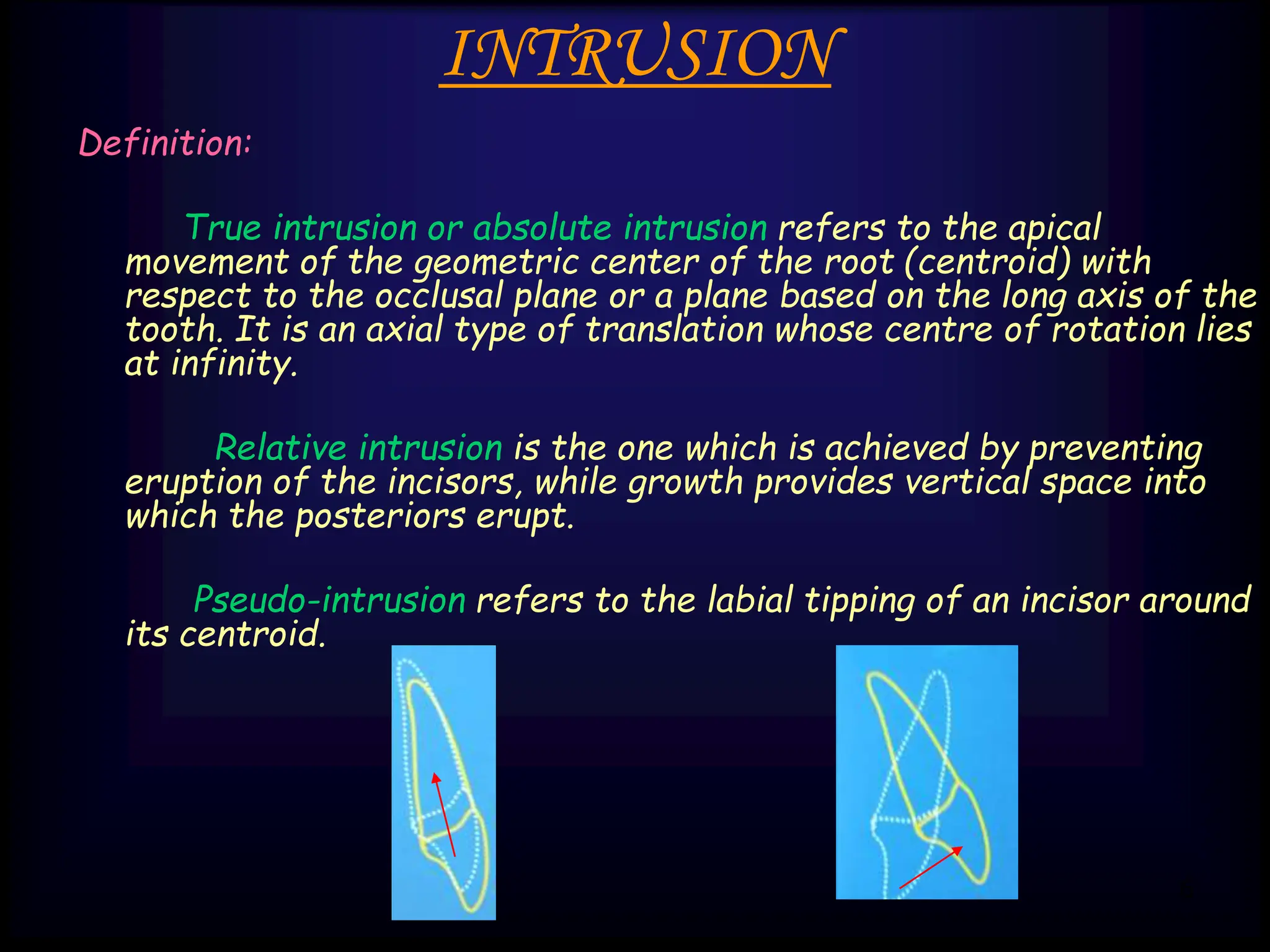 INTRUSION MECHANICS IN ORTHODONTICS..ppt