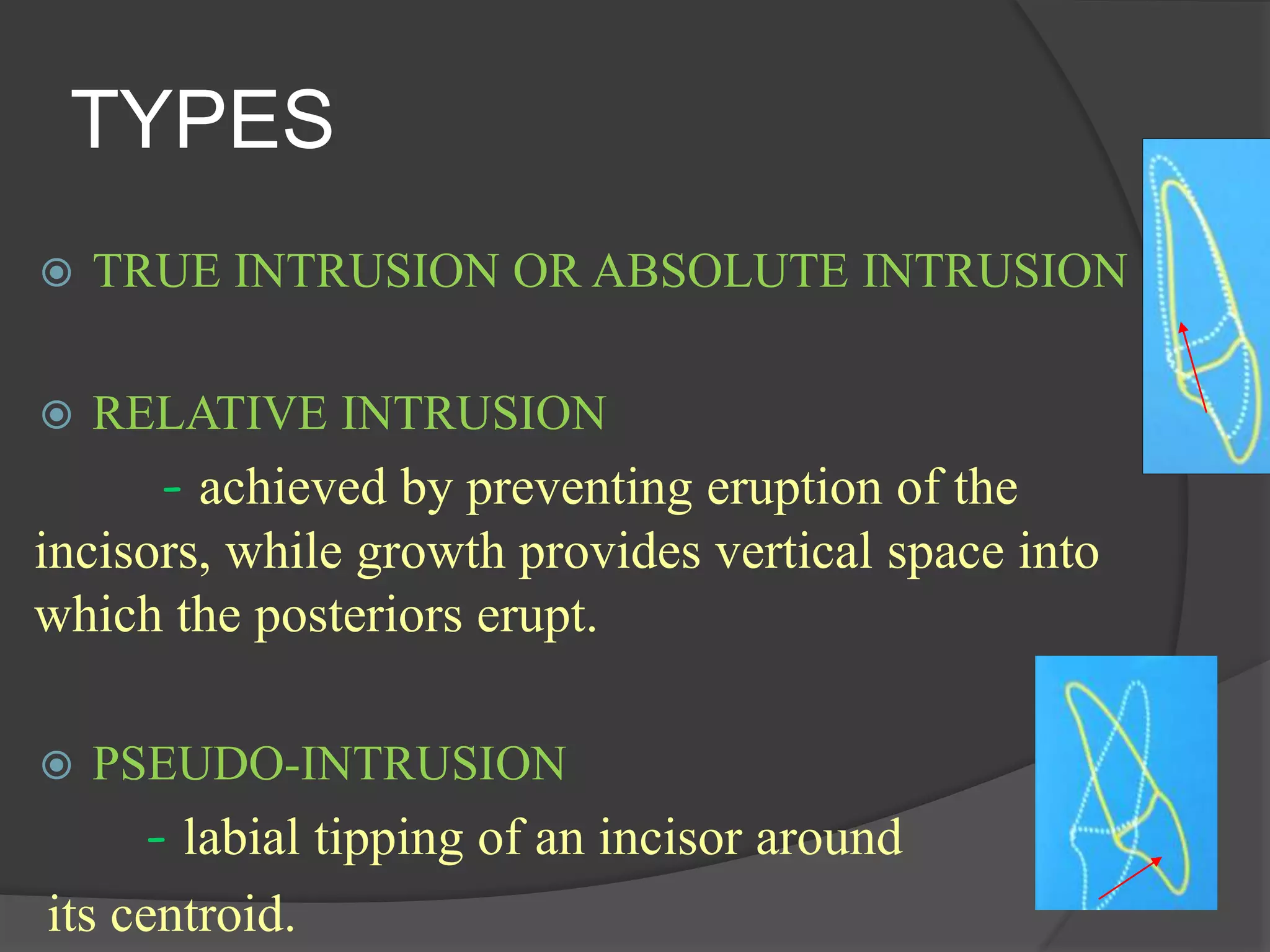 Intrusion mechanics | PPTX