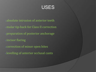 Intrusion mechanics | PPTX