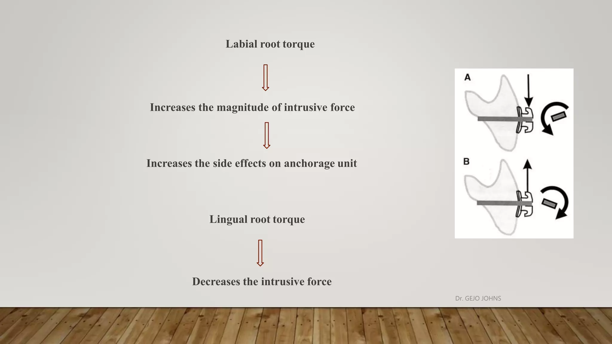 Intrusion mechanics in orthodontics | PPTX