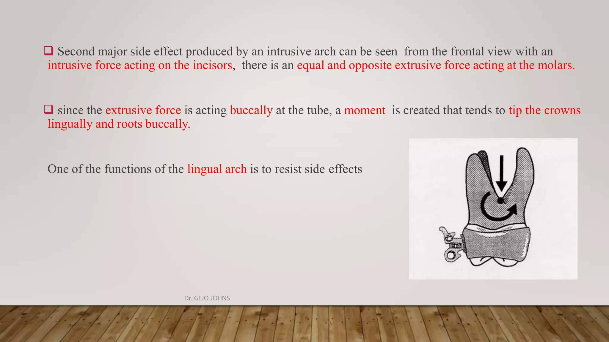 Intrusion mechanics in orthodontics | PPTX