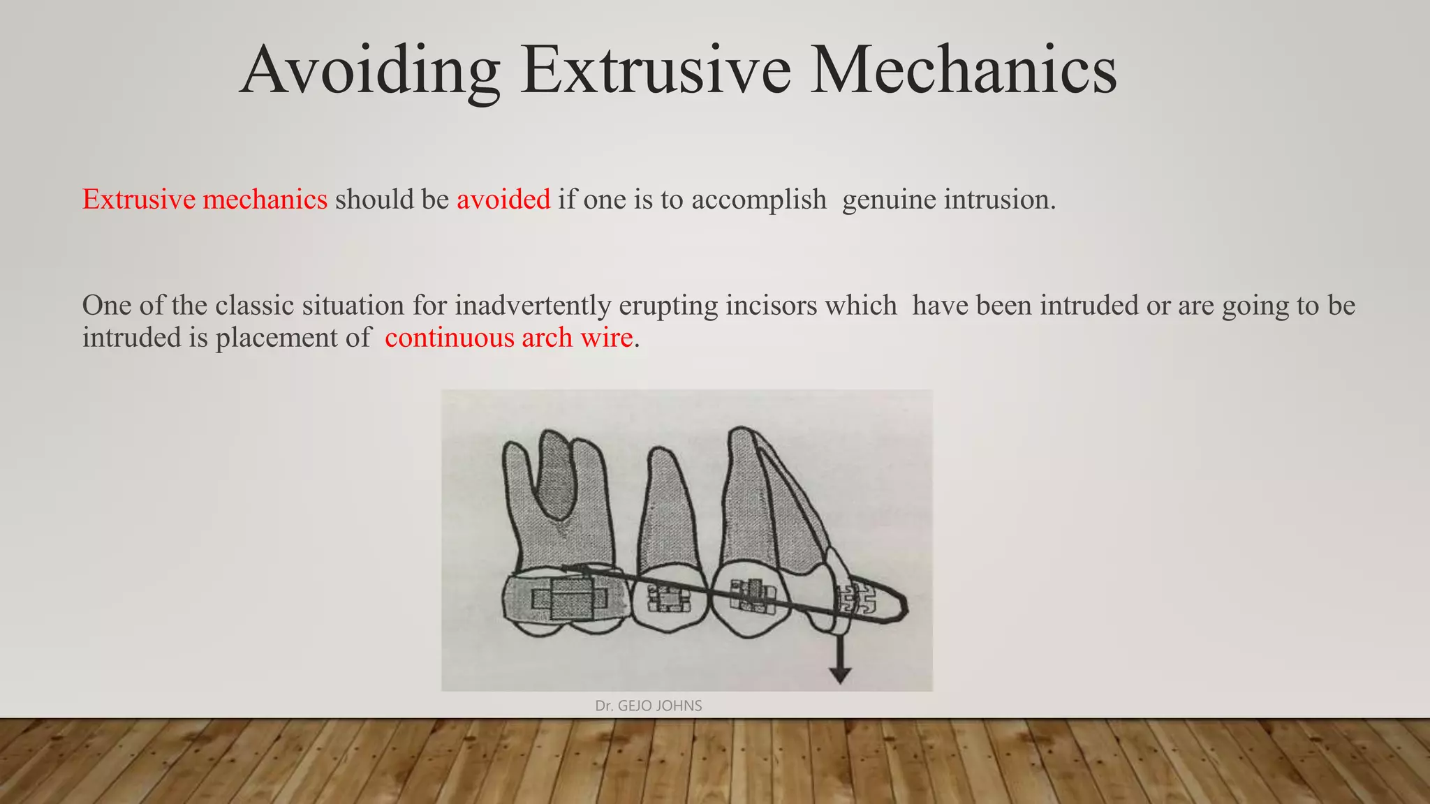 Intrusion mechanics in orthodontics | PPTX