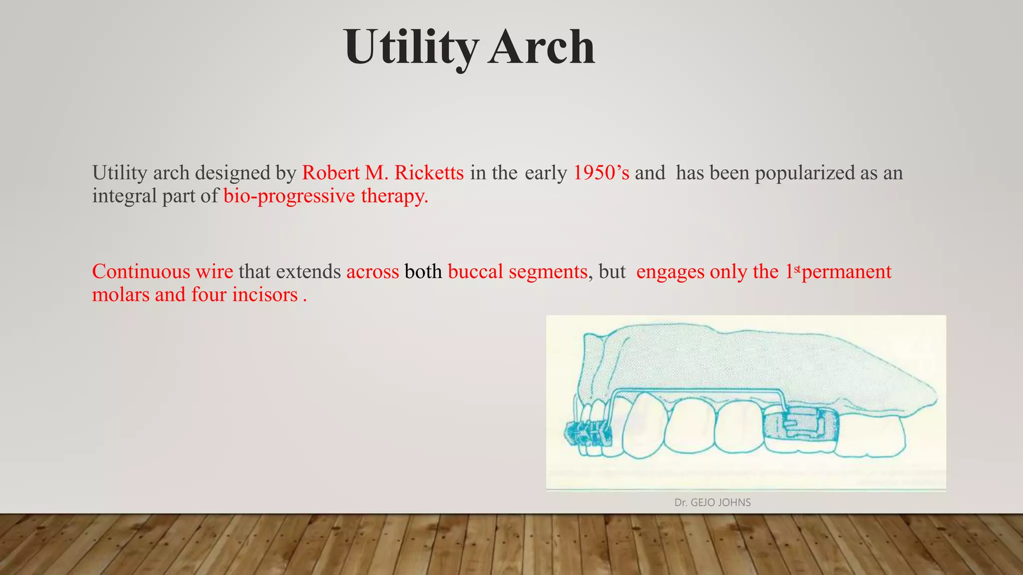 Intrusion mechanics in orthodontics | PPTX