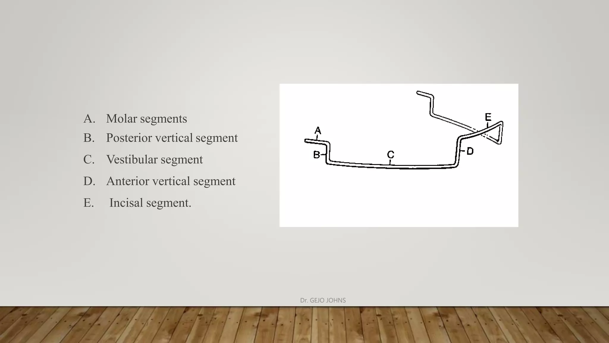 Intrusion mechanics in orthodontics | PPTX