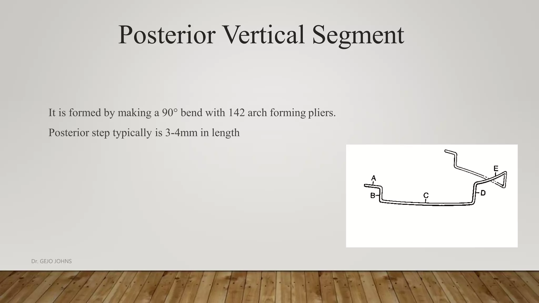 Intrusion mechanics in orthodontics | PPTX