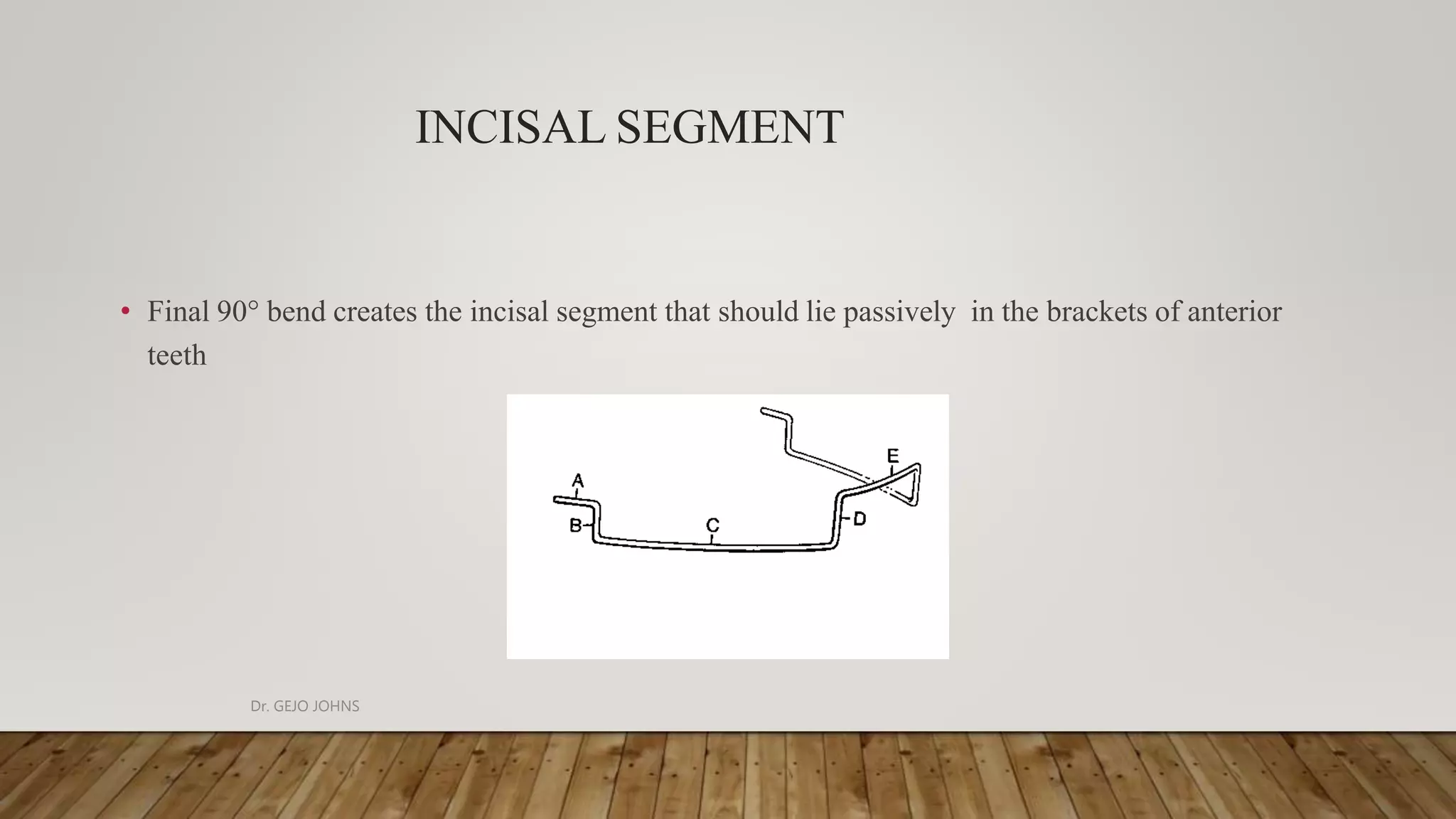 Intrusion mechanics in orthodontics | PPTX