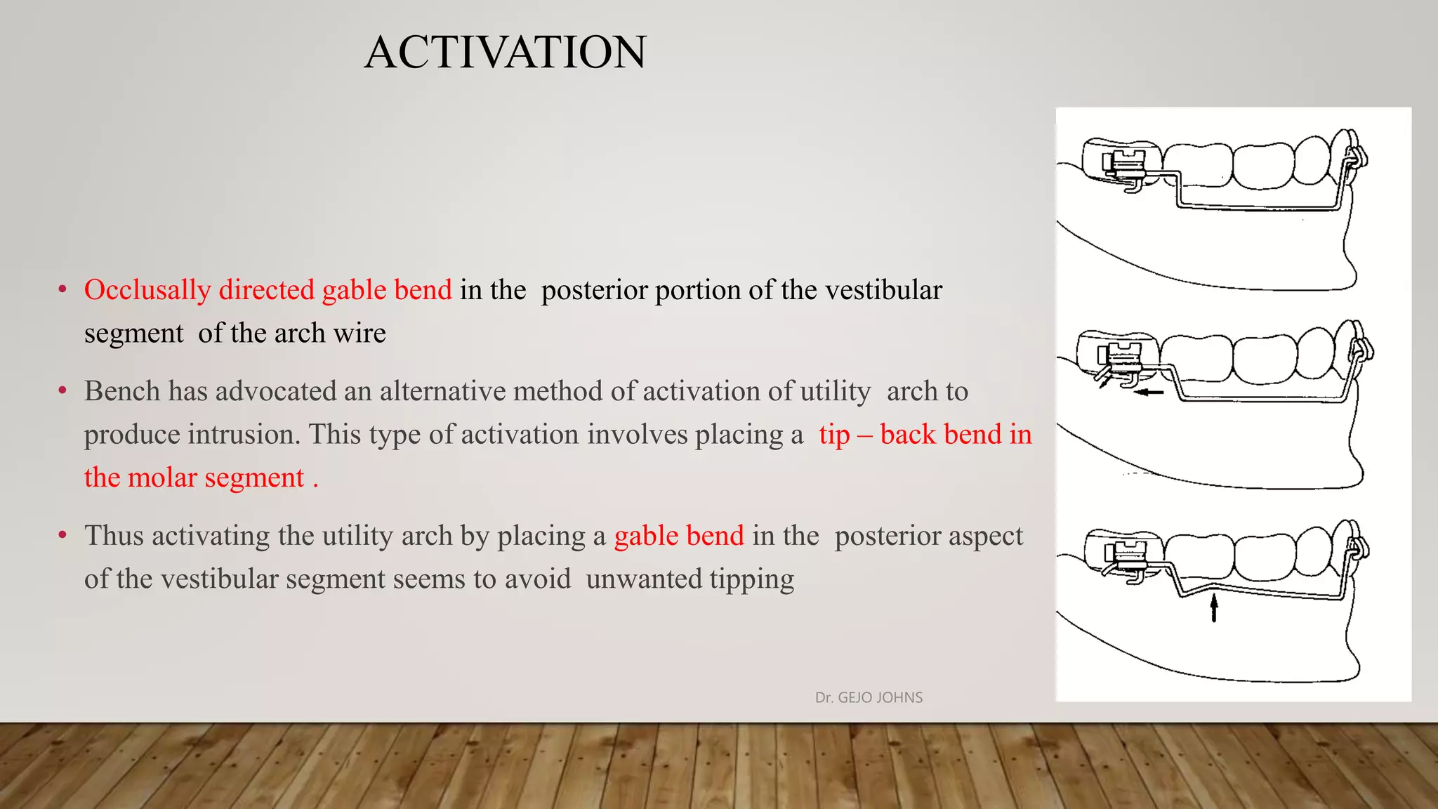 Intrusion mechanics in orthodontics | PPTX
