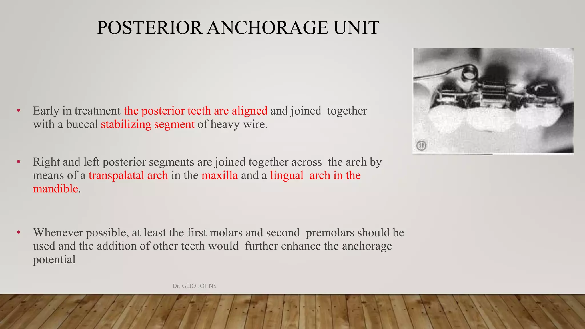 Intrusion mechanics in orthodontics | PPTX