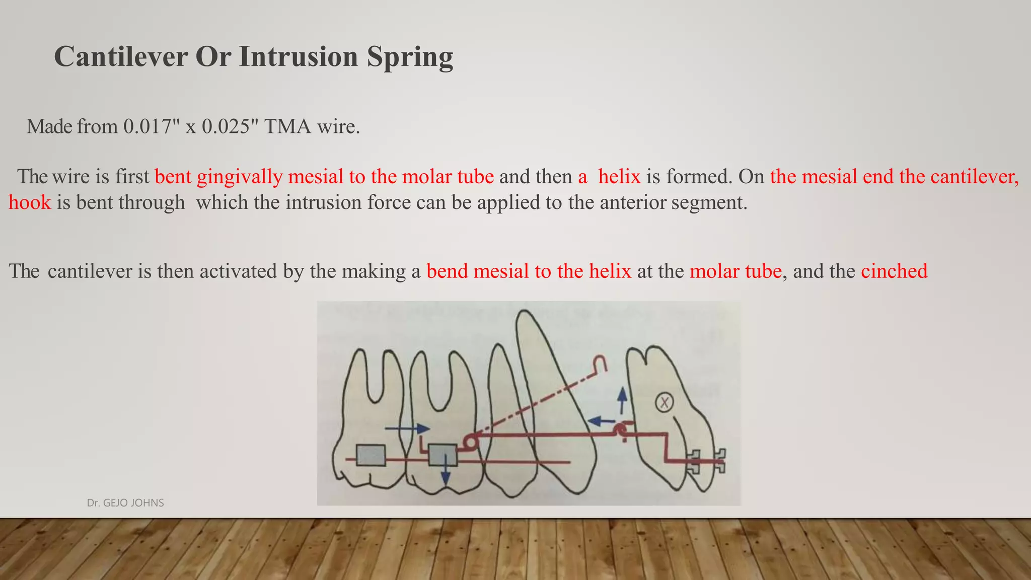 Intrusion mechanics in orthodontics | PPTX
