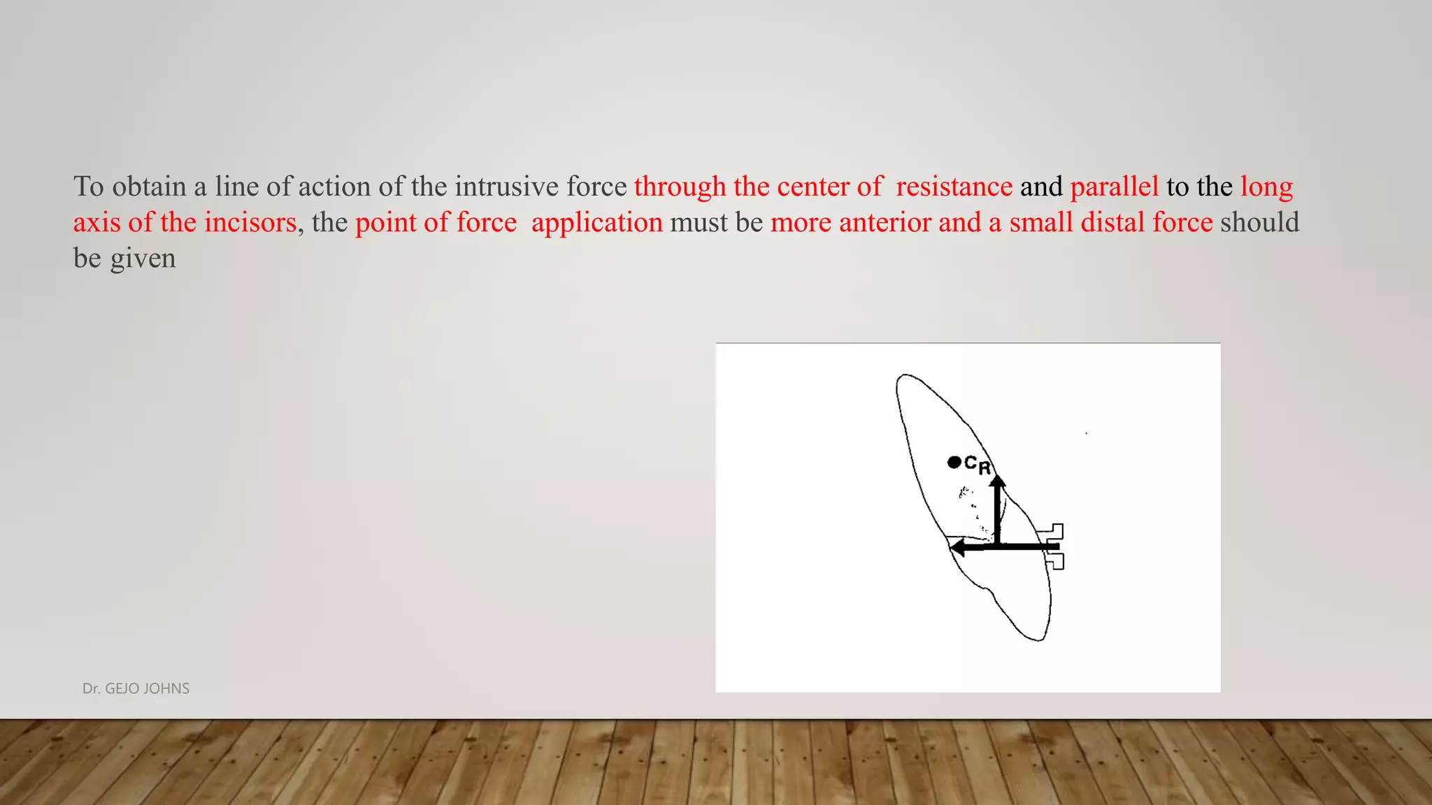 Intrusion mechanics in orthodontics | PPTX