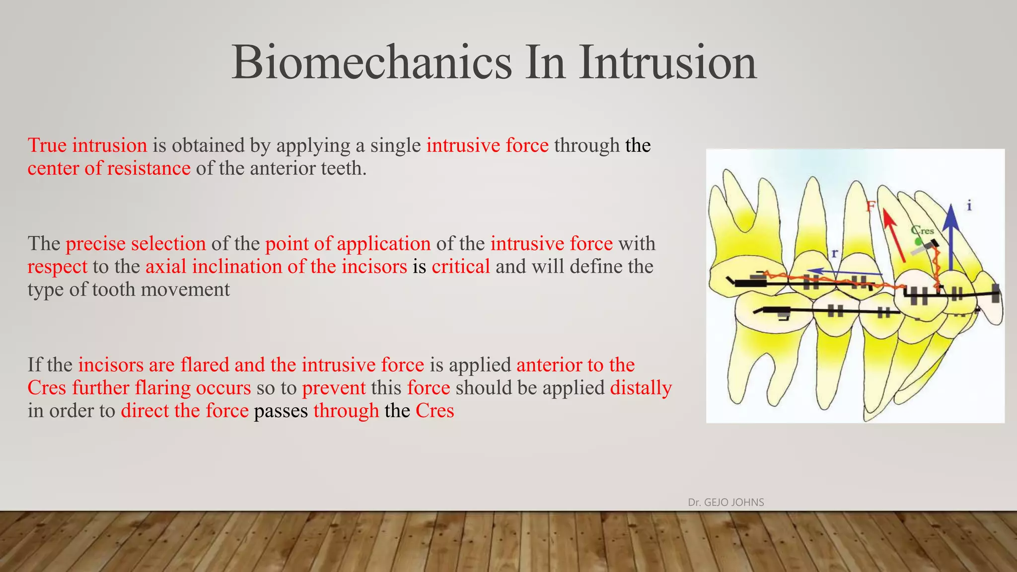 Intrusion mechanics in orthodontics | PPTX