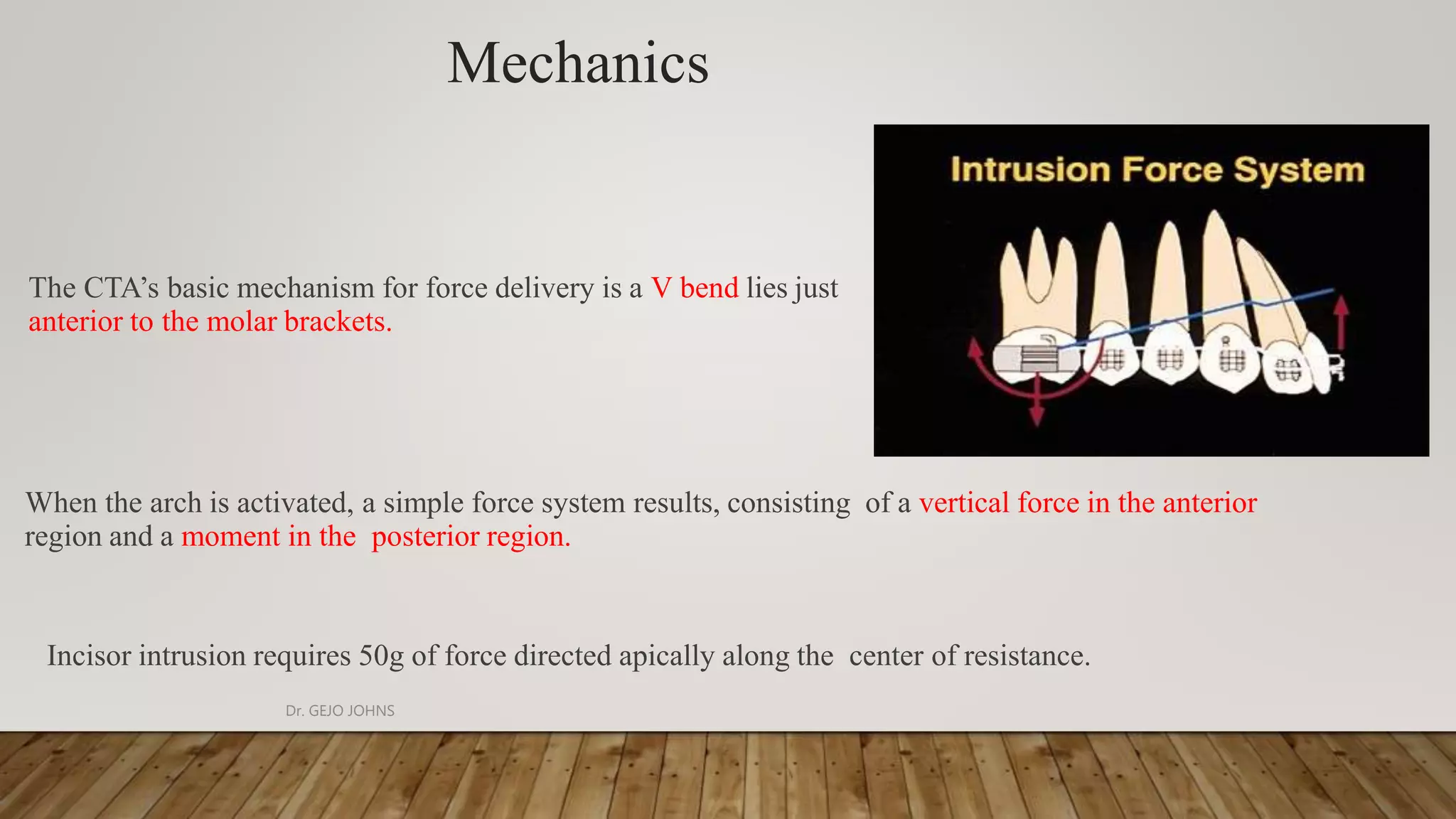 Intrusion mechanics in orthodontics | PPTX