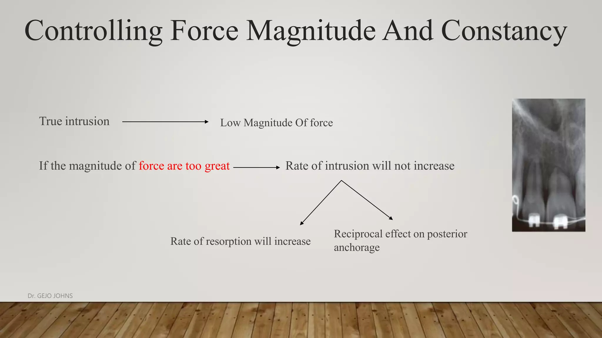 Intrusion mechanics in orthodontics | PPTX