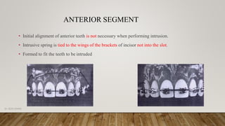 Intrusion mechanics in orthodontics | PPTX