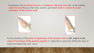 Intrusion mechanics in orthodontics | PPTX