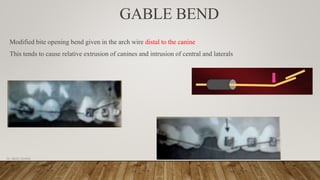 Intrusion mechanics in orthodontics | PPT