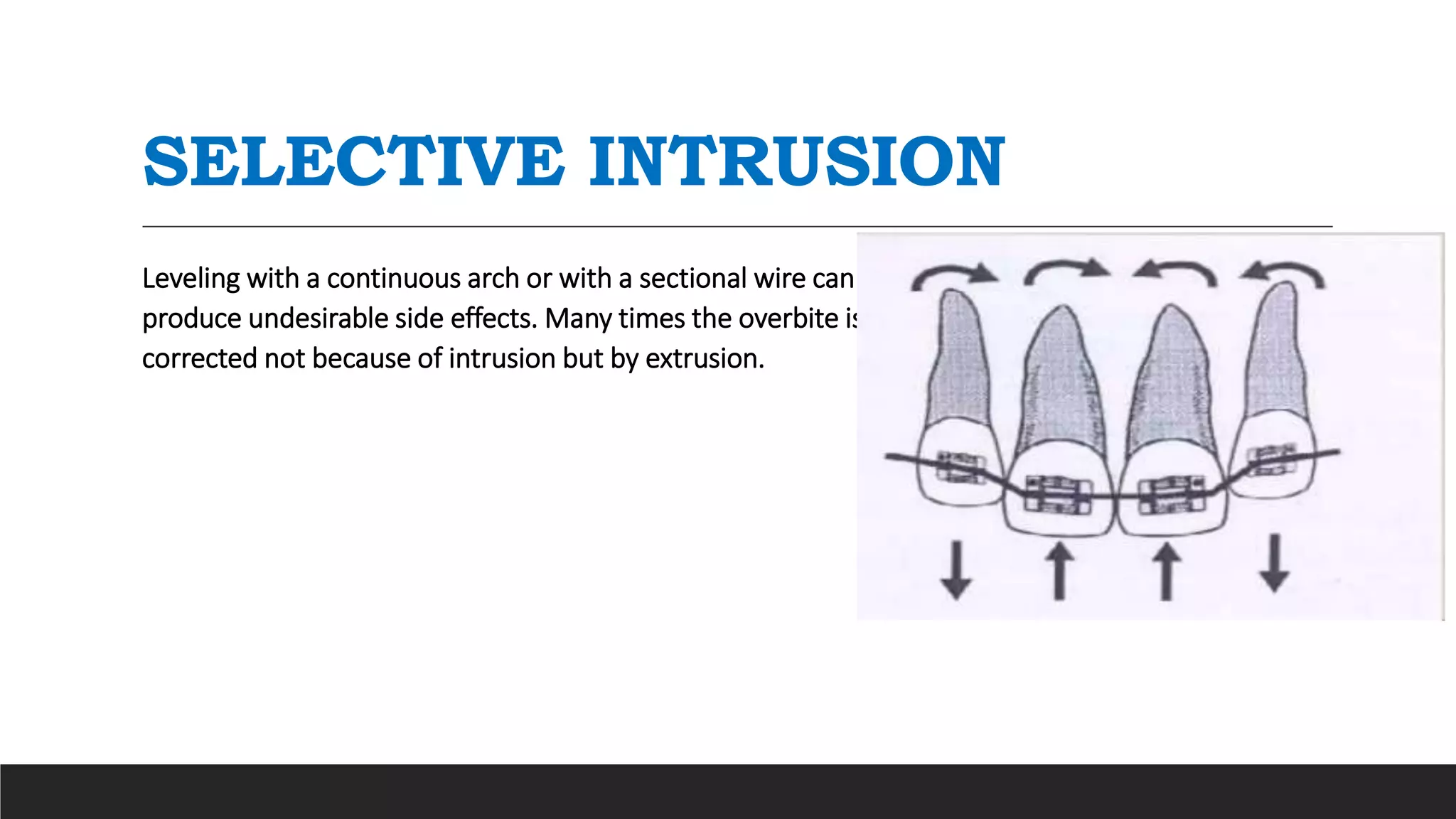 Intrusion PEREPERD BY DR.ABDULGHANI ALMOHAYA ,ALHADDAD.pptx