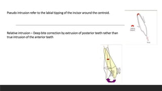 Intrusion PEREPERD BY DR.ABDULGHANI ALMOHAYA ,ALHADDAD.pptx