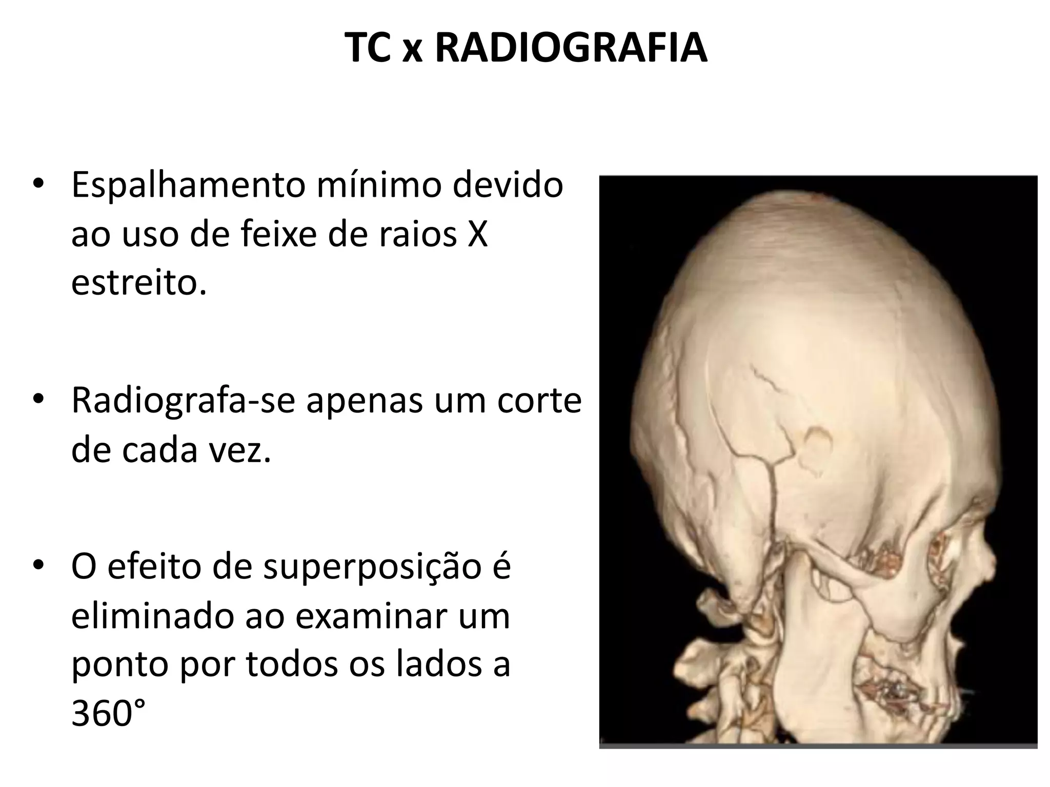 Interpretação de Imagens Tomográficas (TC) | PDF