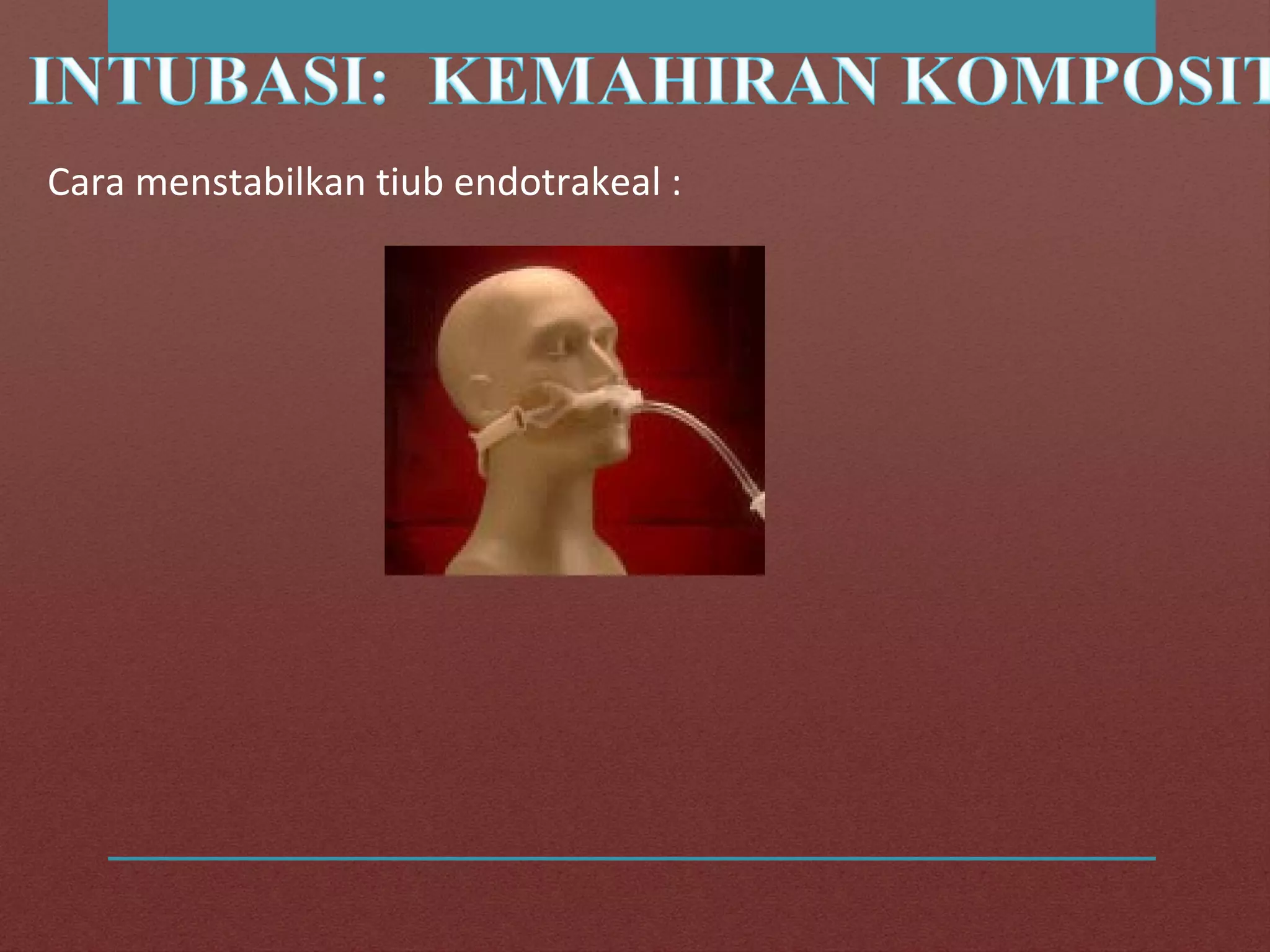 INTUBASI | PPT