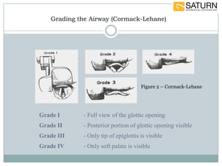 Intubasi sulit pr dr danu1 | PPTX