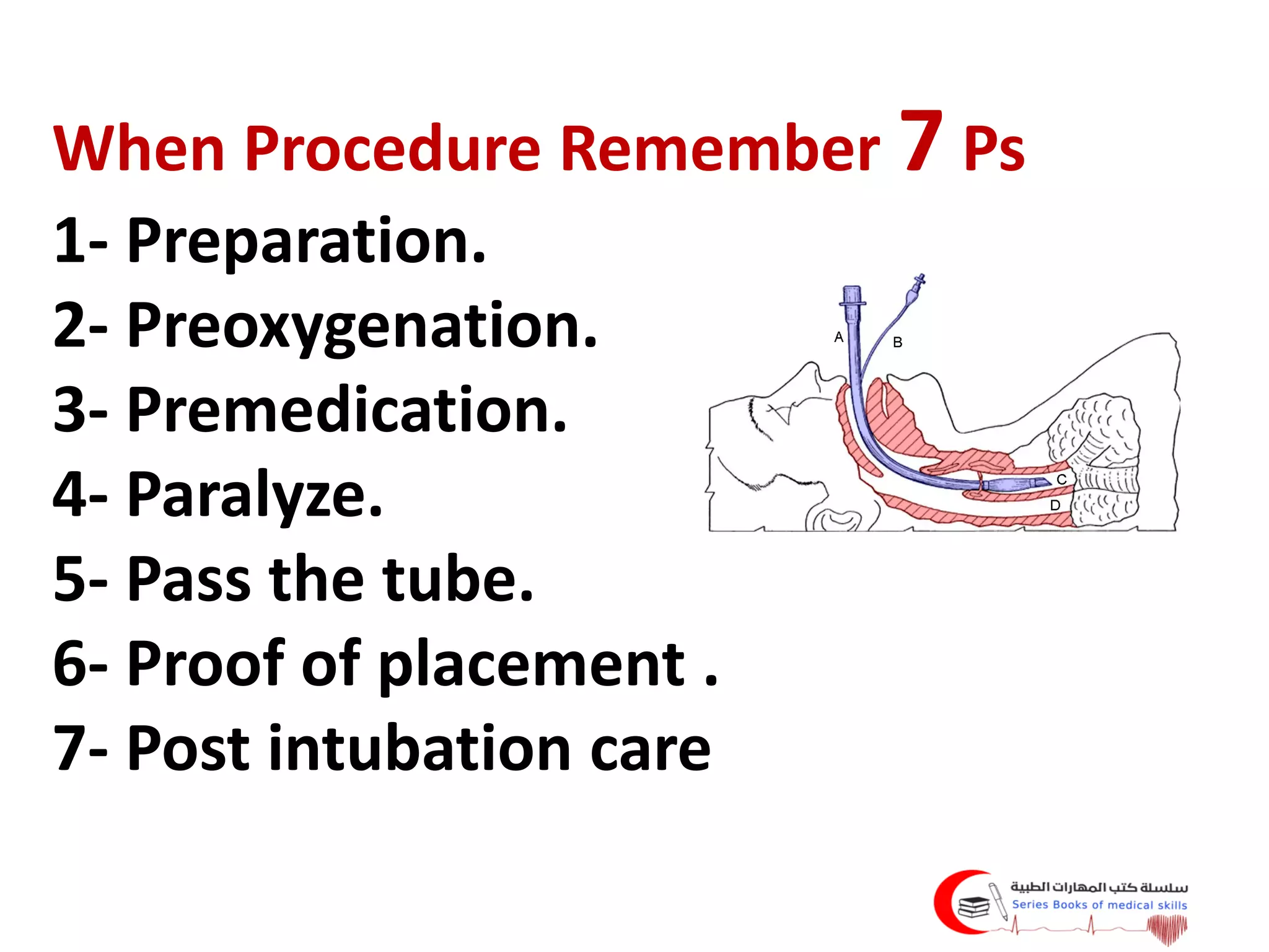 التنبيب الرغامي Intubation.pdf