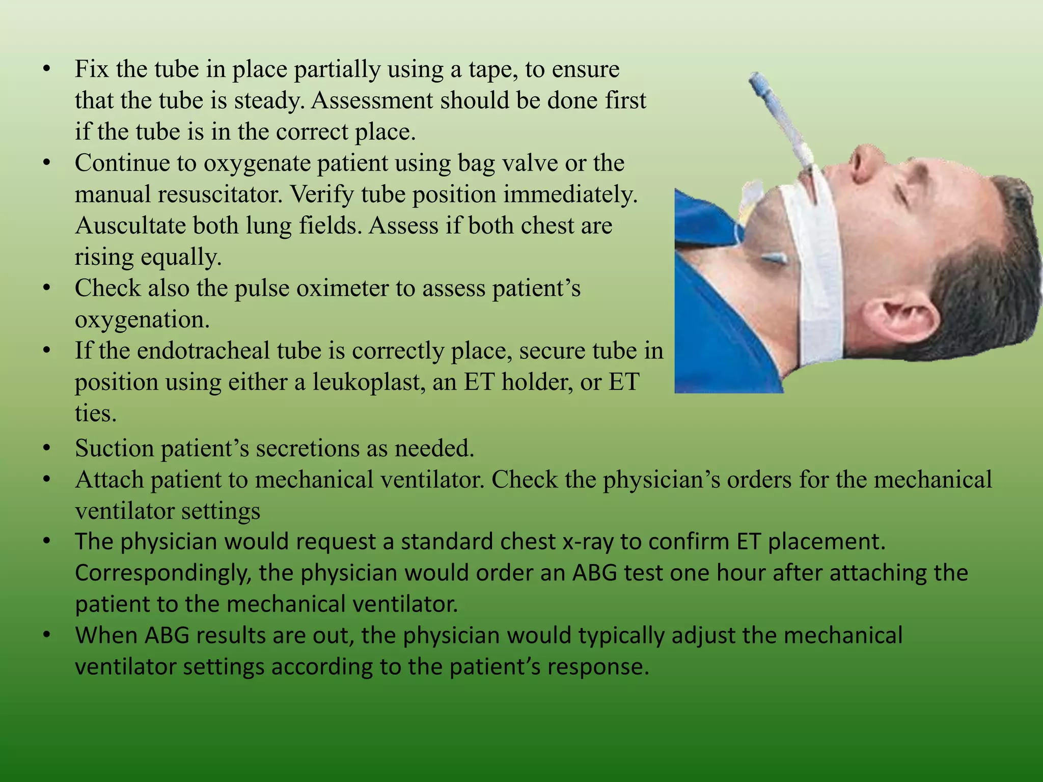 intubation.pptx