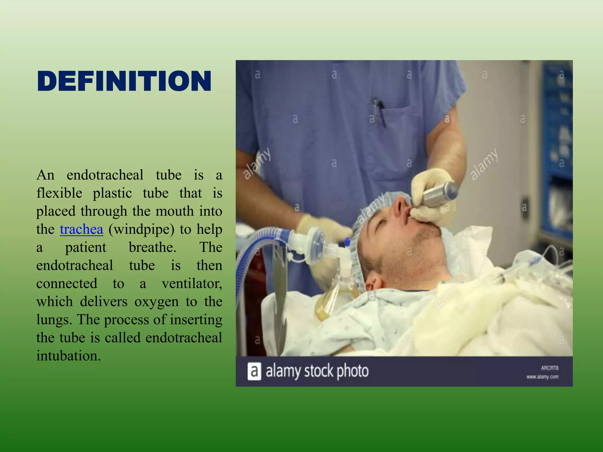 intubation.pptx