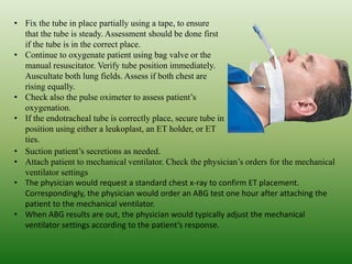 intubation.pptx