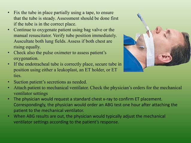 intubation.pptx