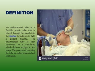 intubation.pptx