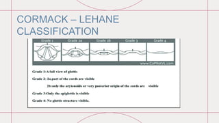 INTUBATION DR.MANISHA(RSI & DSI).pptx ppt | PPTX
