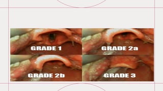 INTUBATION DR.MANISHA(RSI & DSI).pptx ppt | PPTX