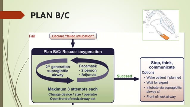 Intubation in critical care setting | PPTX | Lung and Respiratory ...