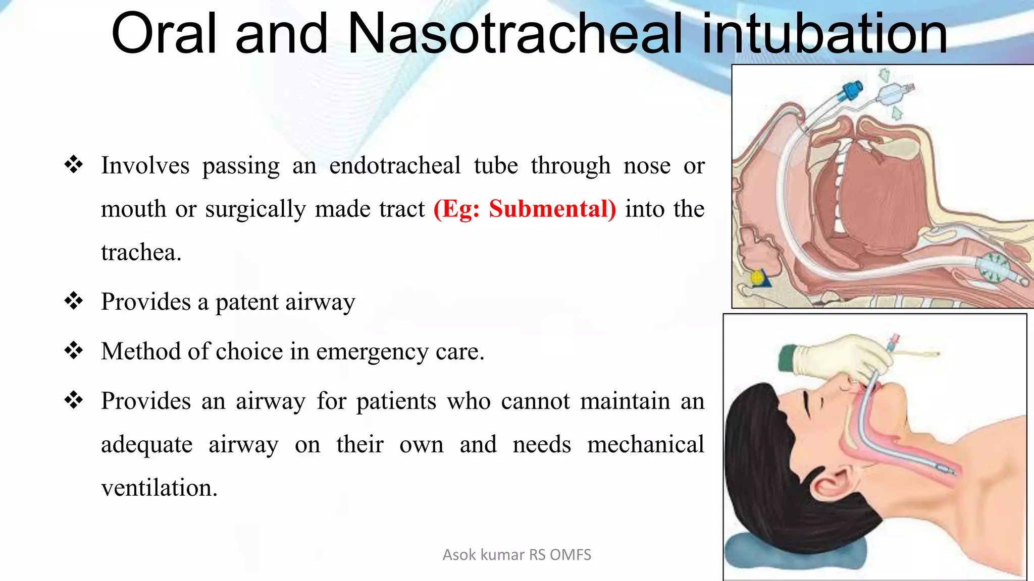 Intubation in omfs | PDF