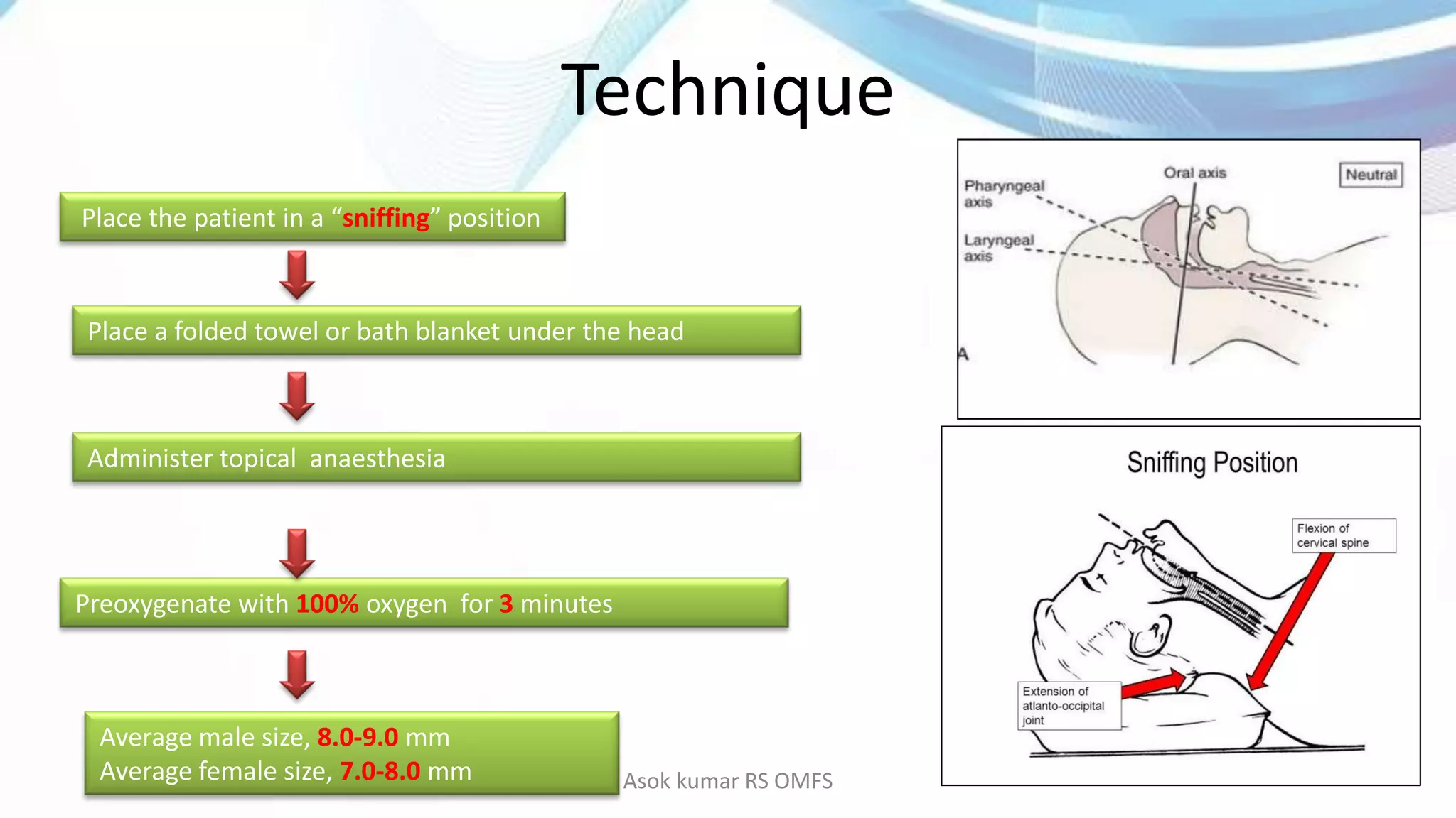 Intubation in omfs | PDF