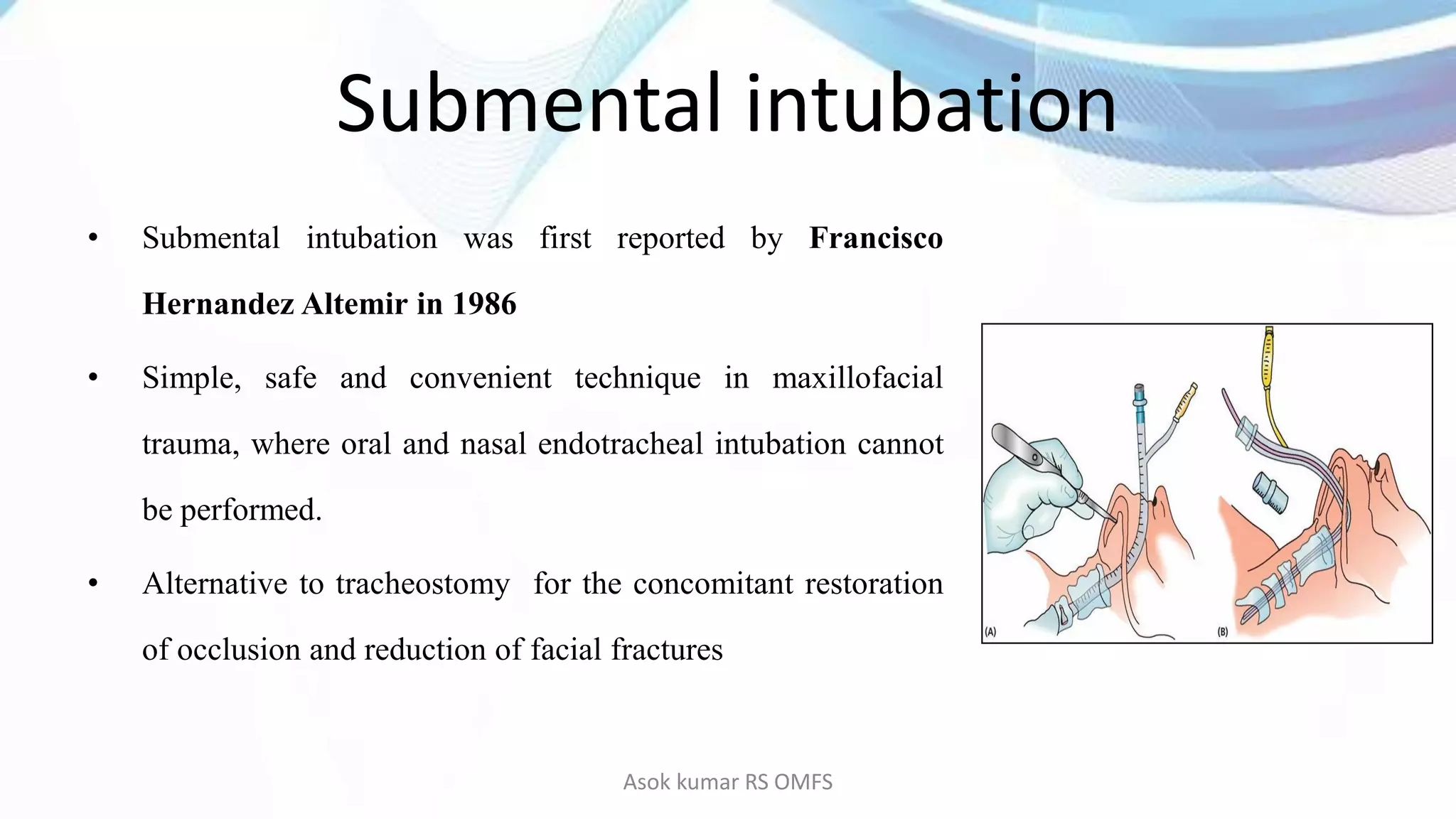 Intubation in omfs | PDF
