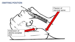 Intubation part 1. | PPTX