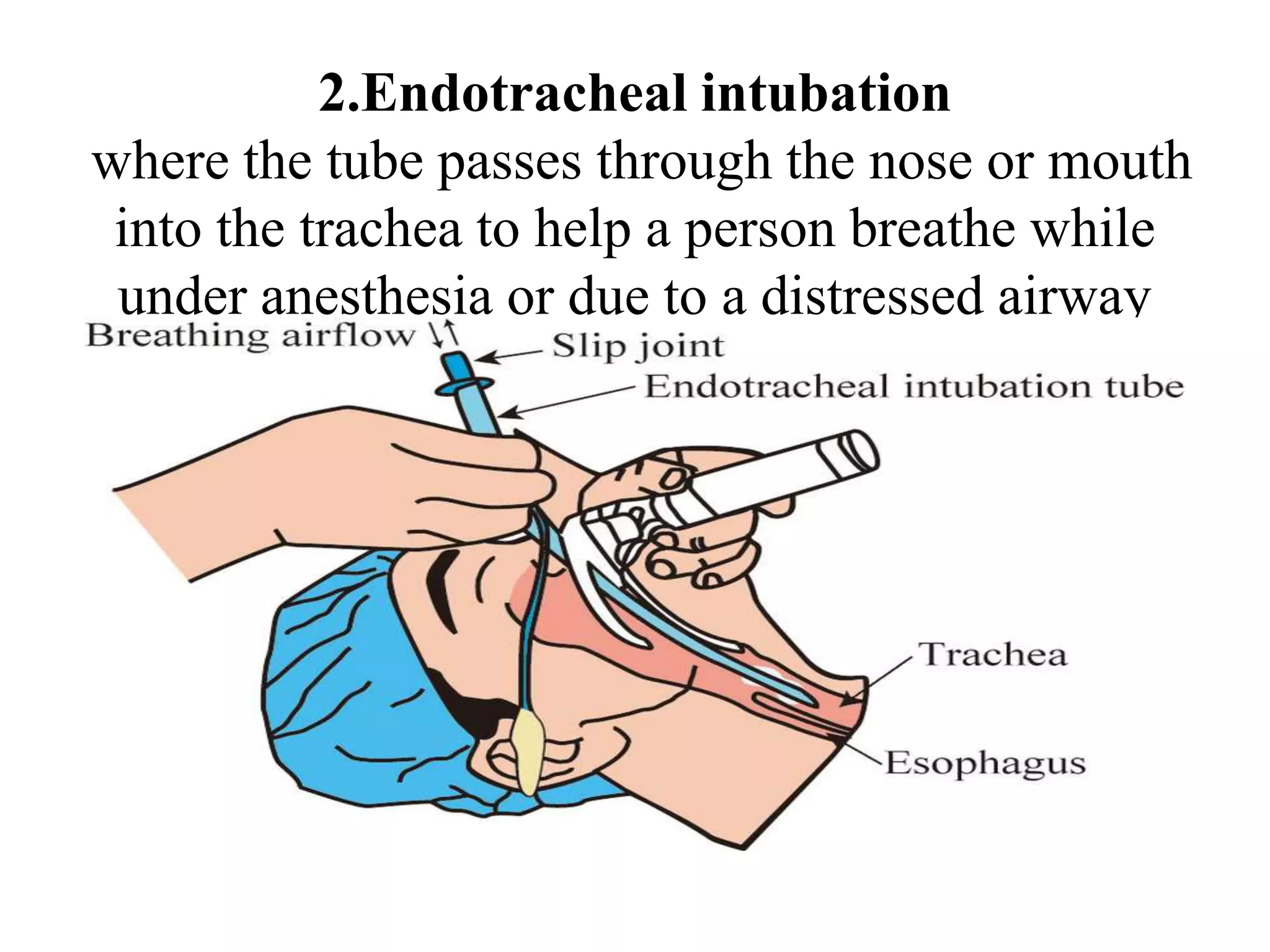 Intubation ppt | PPTX