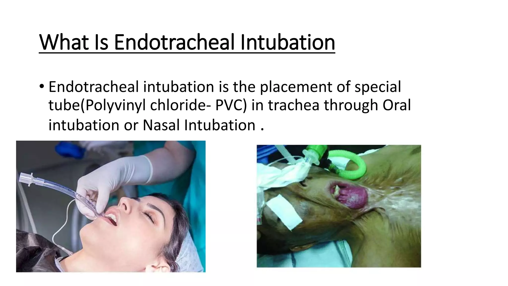 intubation ppt.pptx