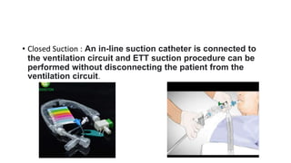 intubation ppt.pptx