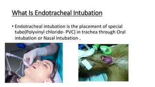 intubation ppt.pptx
