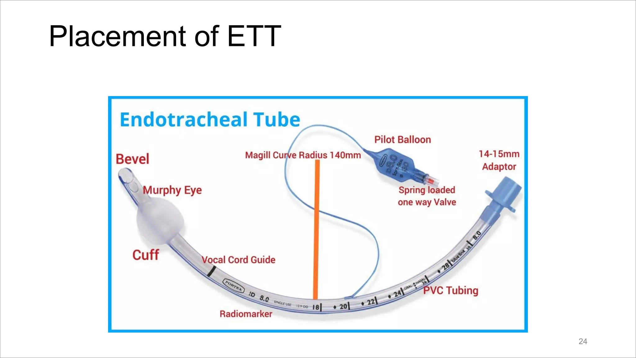 Intubation, Tracheostomy,Cricothyroidotomy.pdf