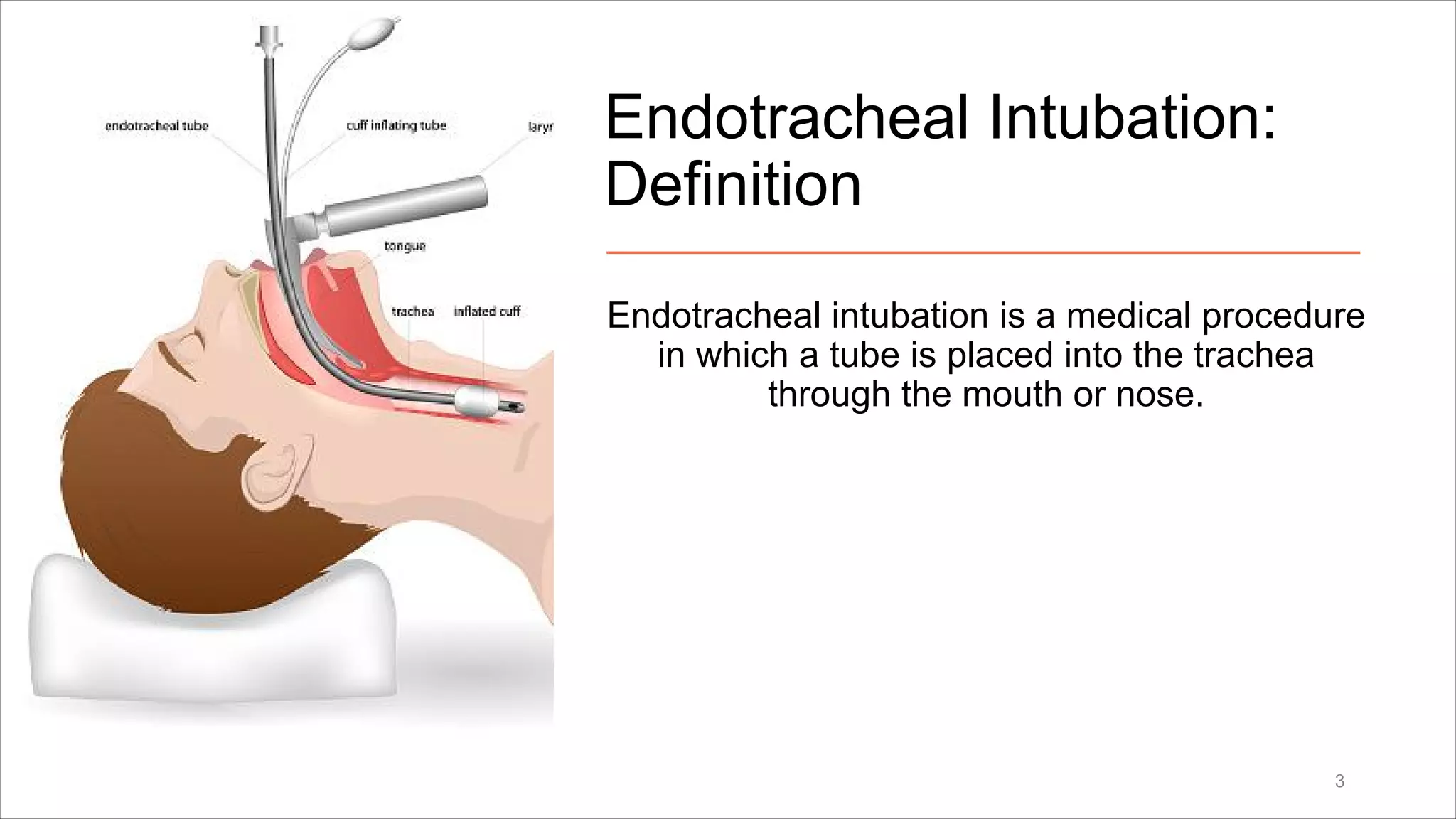 Intubation, Tracheostomy,Cricothyroidotomy.pdf
