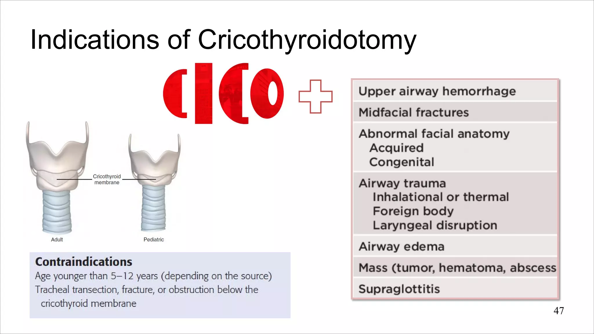 Intubation, Tracheostomy,Cricothyroidotomy.pdf